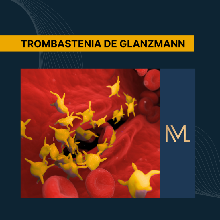 TROMBASTENIA DE GLANZMANN - INML