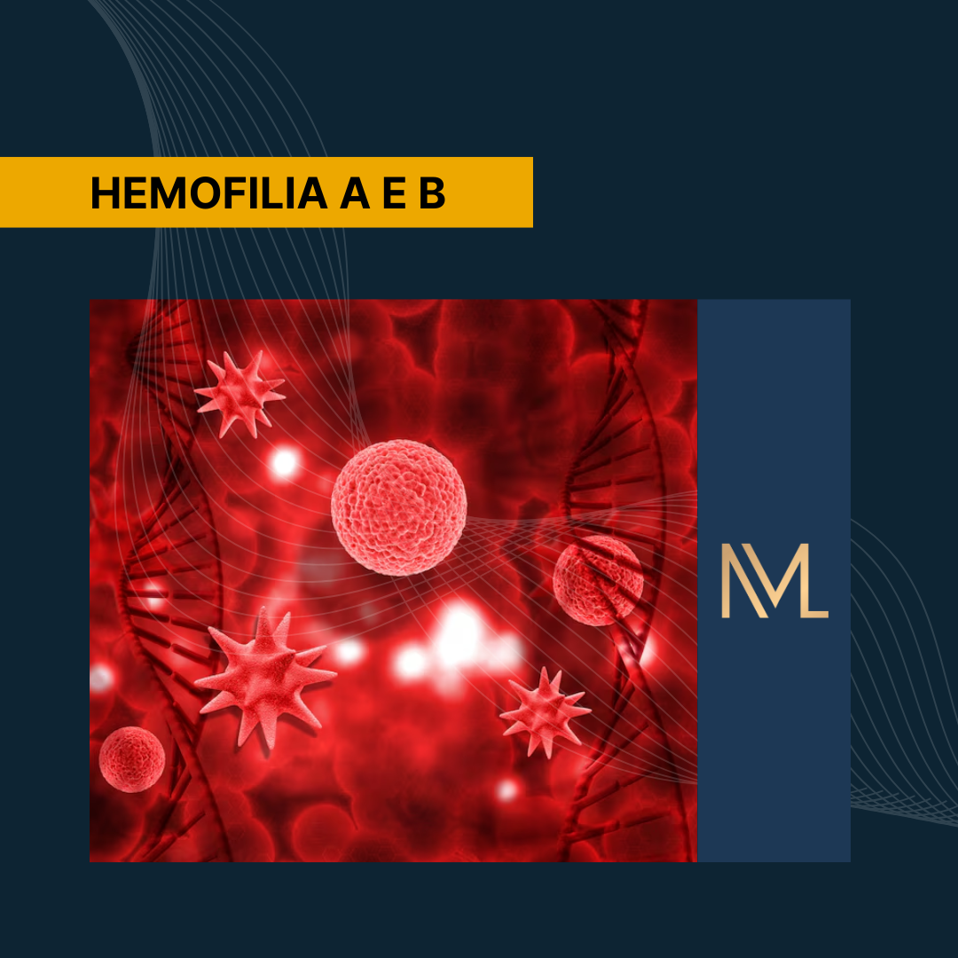 HEMOFILIA A E B - INML