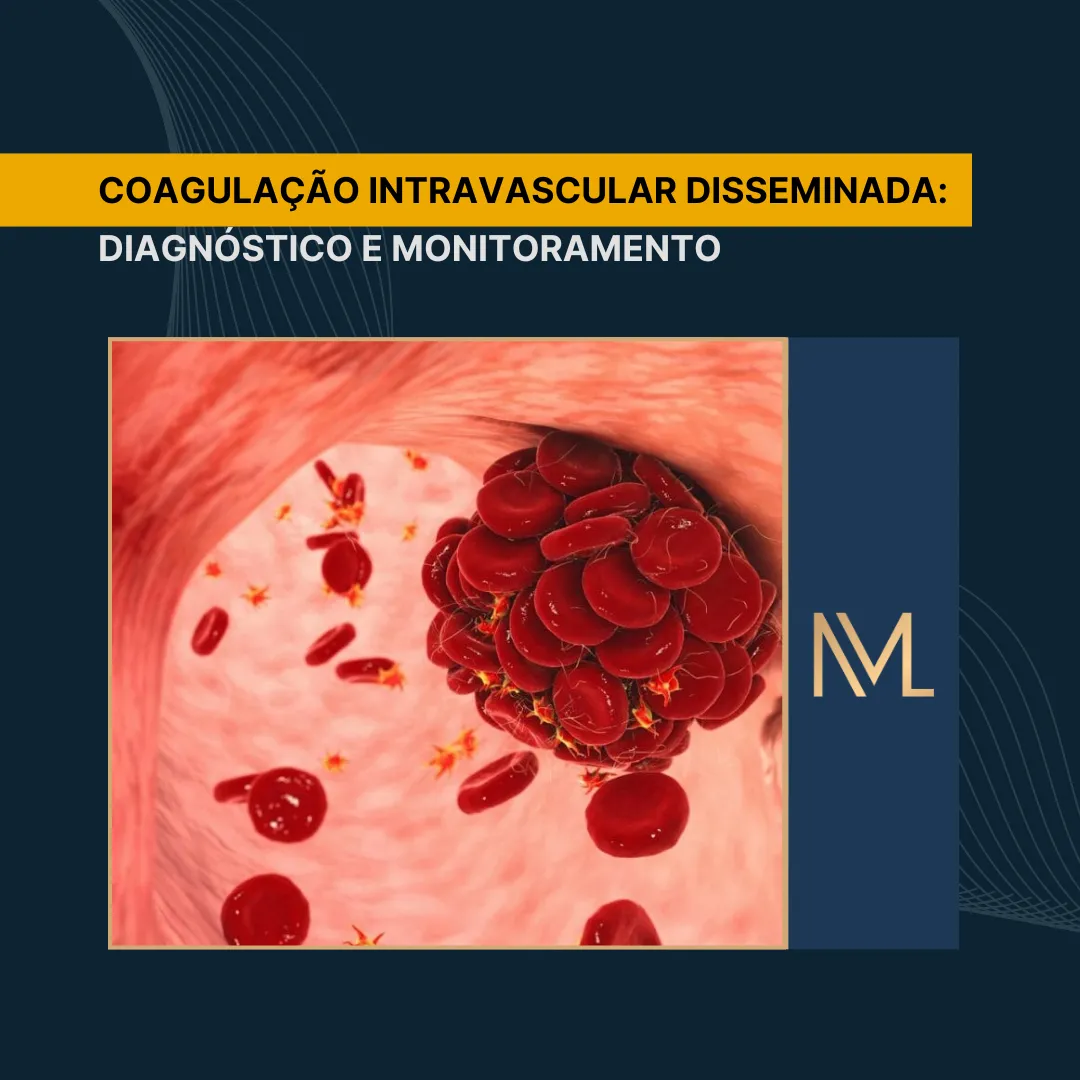 Coagulação Intravascular Disseminada: Diagnóstico e Monitoramento - INML
