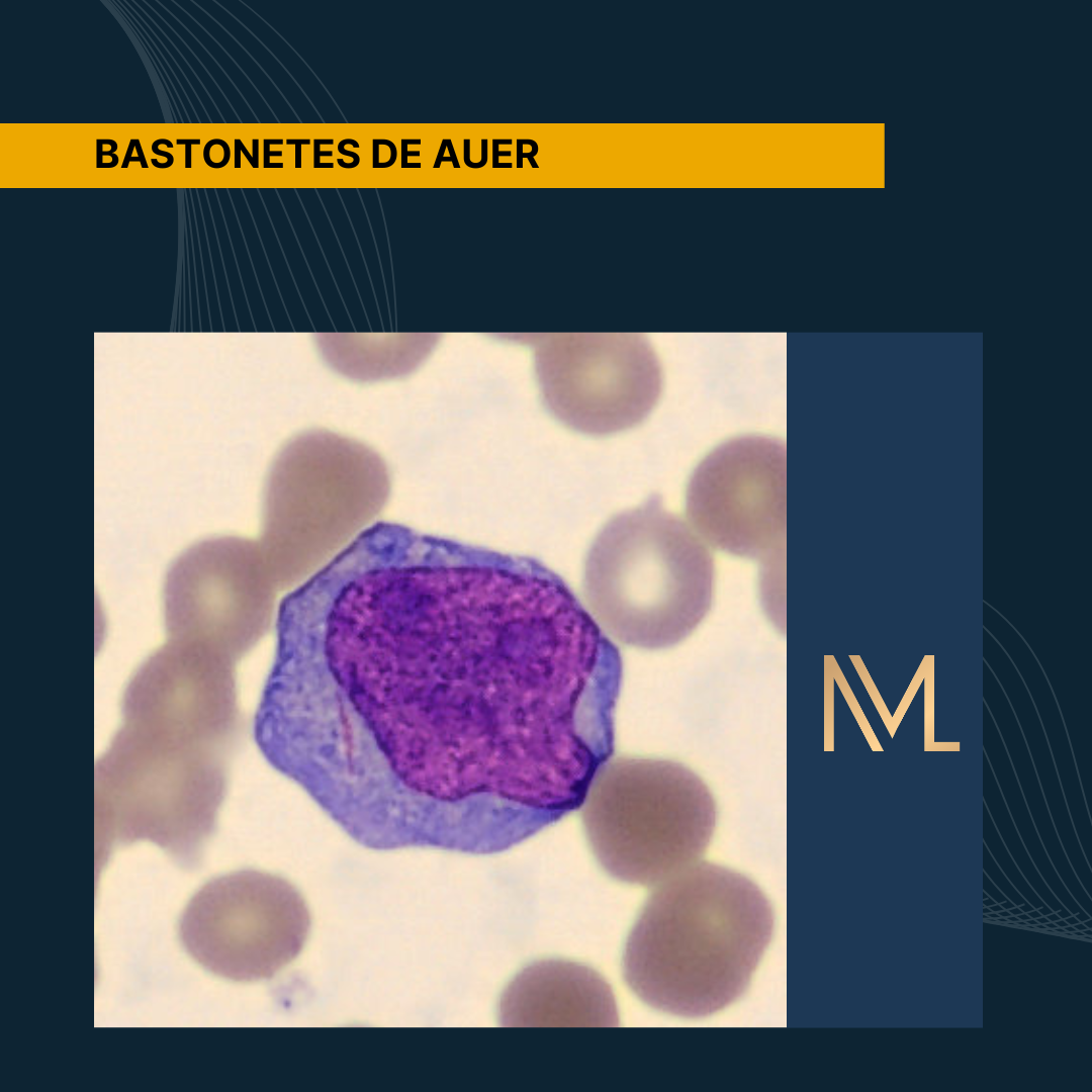 Bastonetes de Auer - INML
