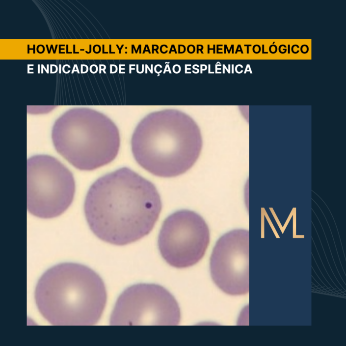 Howell-Jolly: marcador hematológico e indicador de função esplênica - INML